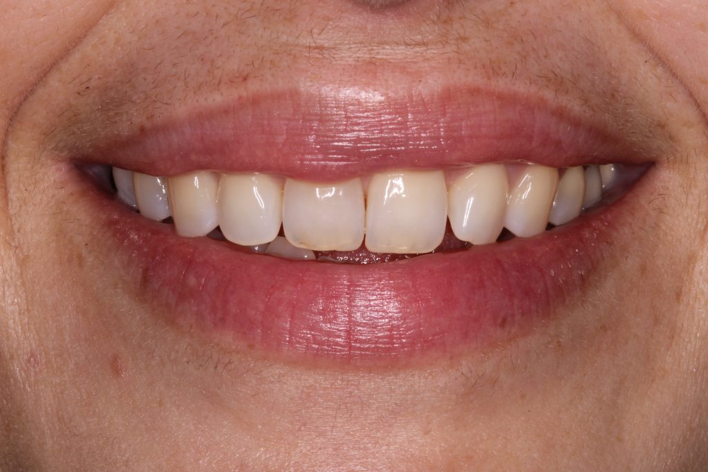Img 0421